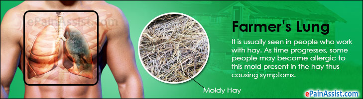 Farmers Lung: Treatment, Causes, Symptoms