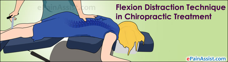 Flexion Distraction Technique in Chiropractic Treatment: Conditions ...