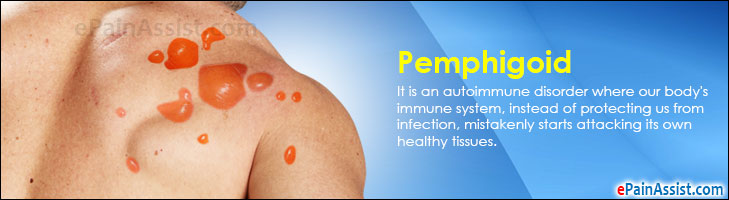 Pemphigoid|Types|Causes|Risk Factors|Signs|Symptoms|Investigations ...