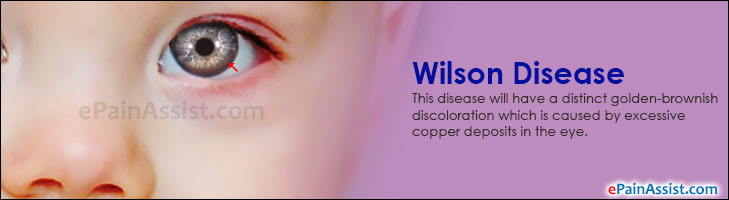 Wilson Disease: Treatment, Prognosis, Symptoms, Causes