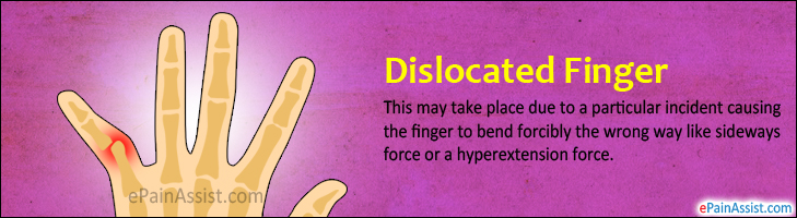Dislocated Finger|Types|Causes|Symptoms|Treatment-Metal Implants, Exercises