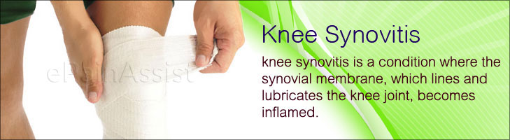 Knee Synovitis|Causes|Symptoms|Treatment|PVNS of Knee