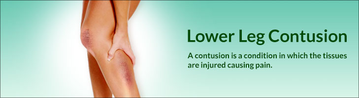 Lower Leg Contusion|Symptoms|Treatment|Stretching, Strengthening ...