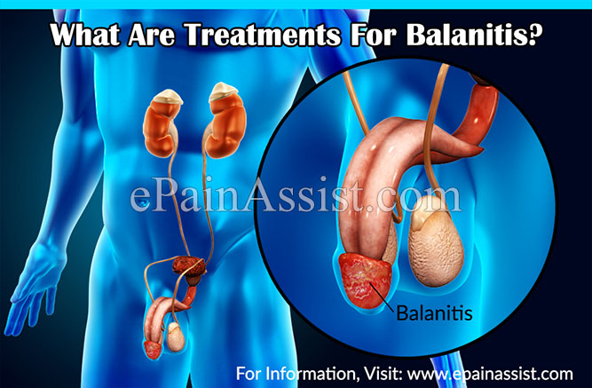 What Is Balanitis Know Its Treatment Causes Symptoms Home Remedies What Is Balanitis Know Its Treatment Causes Symptoms Home Remedies
