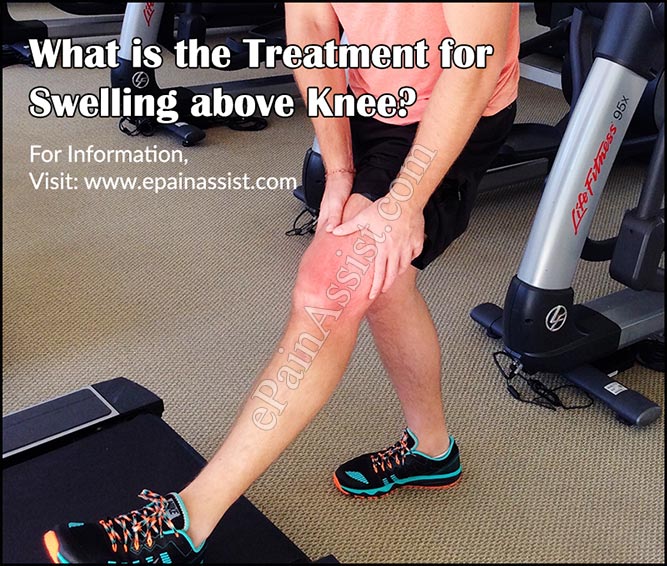 What Can Cause Swelling Above Knee What Is Its Treatment 