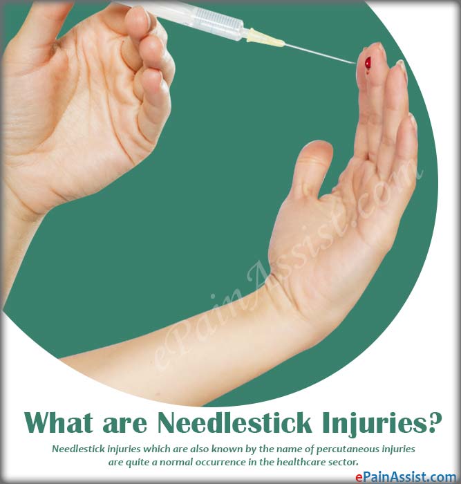 Watch Full Movie Needlestick With English Subtitles In QHD Qacugiy